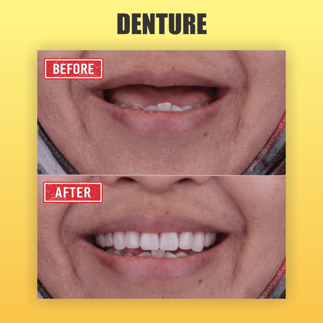 SMILE HERITAGE DENTAL CLINIC – We Design Your Smile